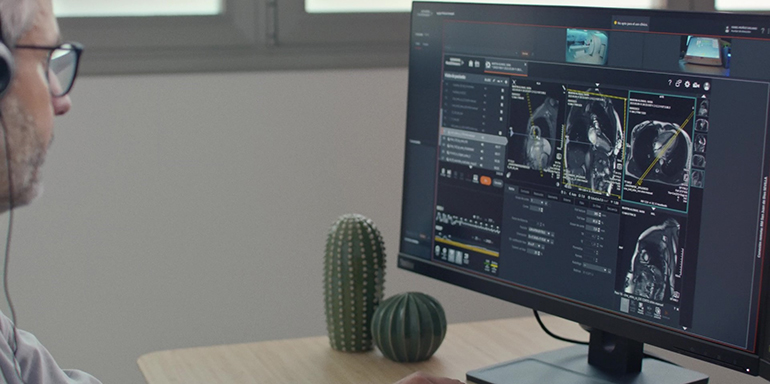 Nuevo software de asistencia en remoto para mejorar la experiencia de ...